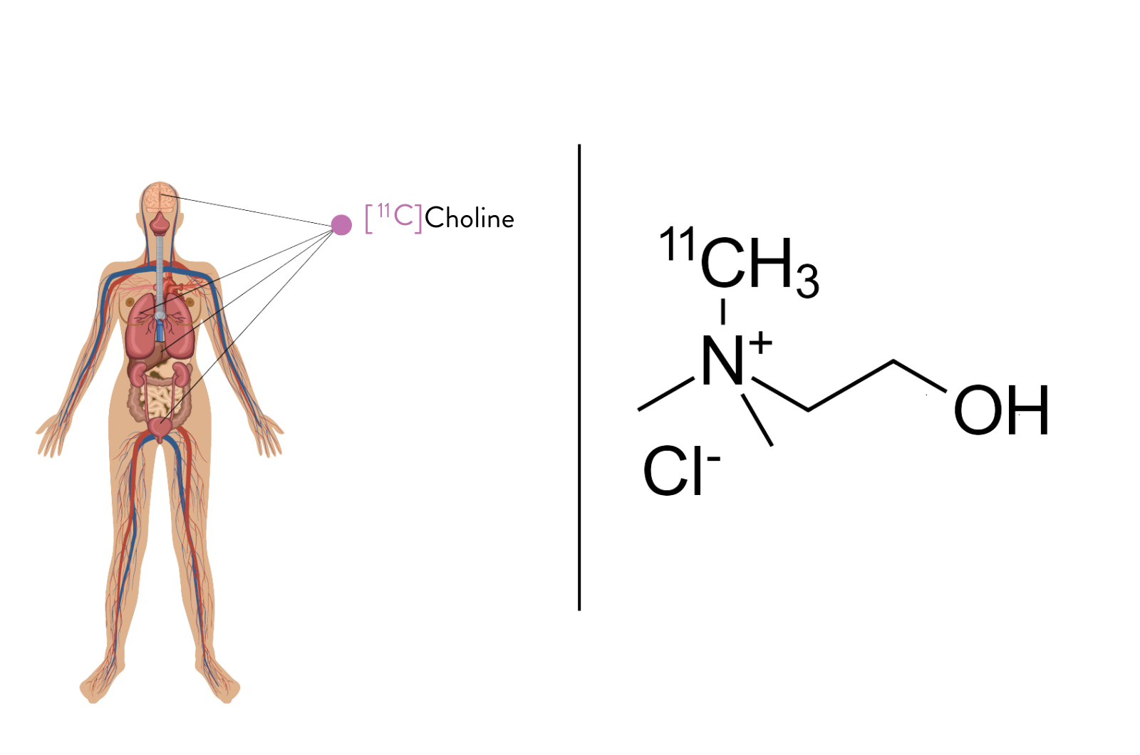[11C]Choline | Trasis